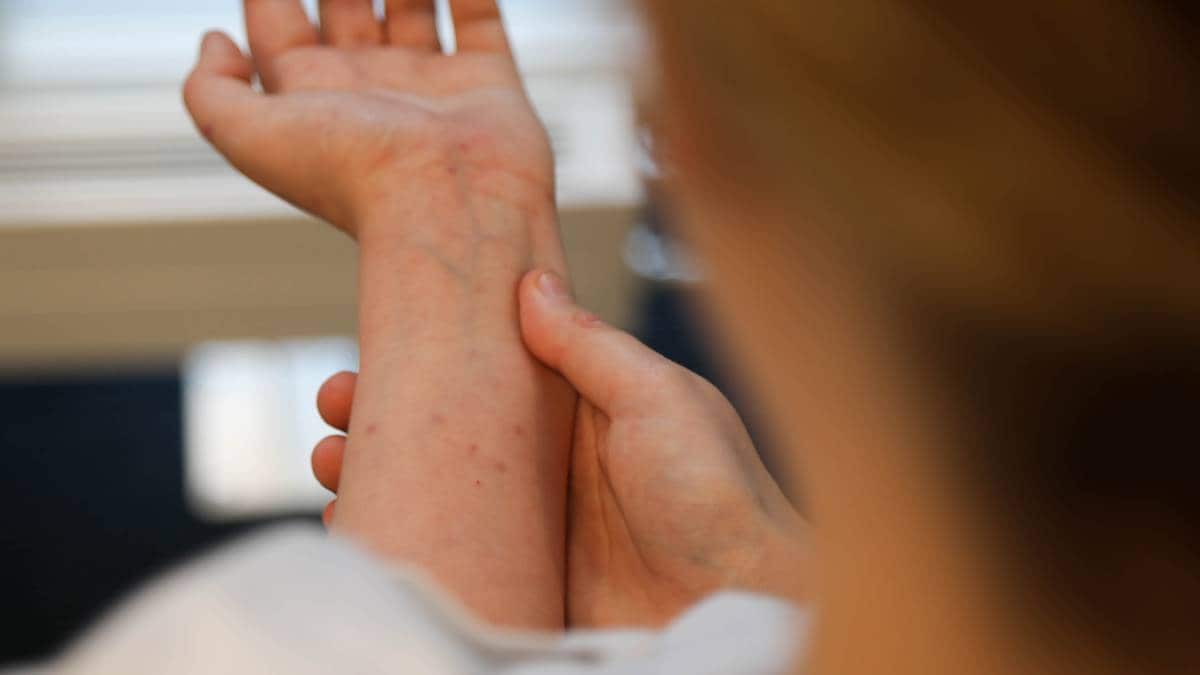 Dukker opp nye skabb-tilfeller i Hjartdal – NRK Vestfold og Telemark – Lokale nyheter, TV og radio