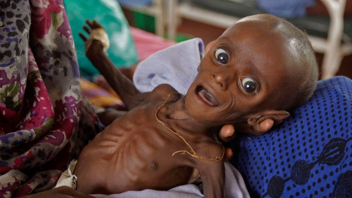 Sult – Siste nytt – NRK