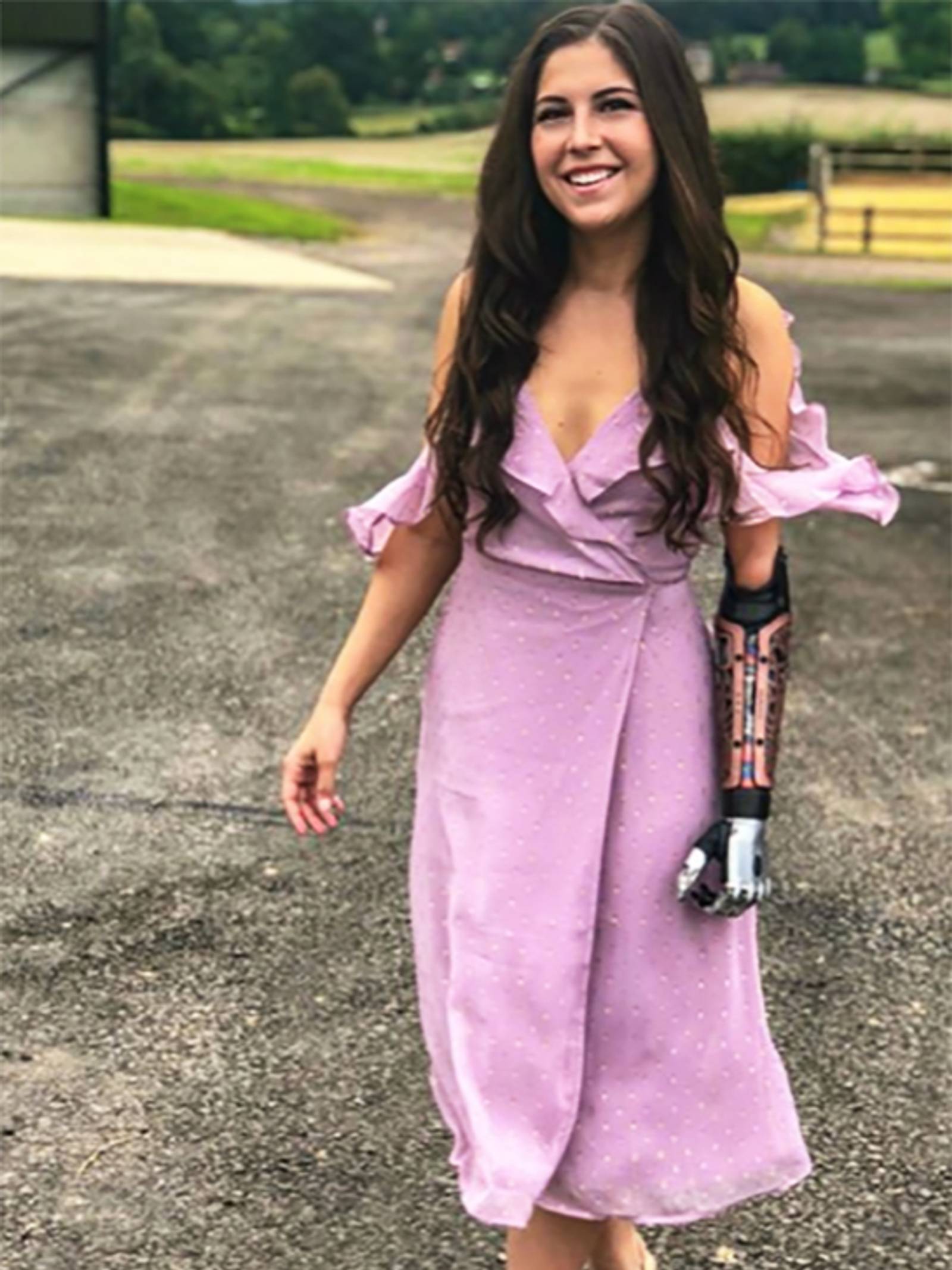 Sier avanserte armproteser forandrer forholdet til andre mennesker – Urix