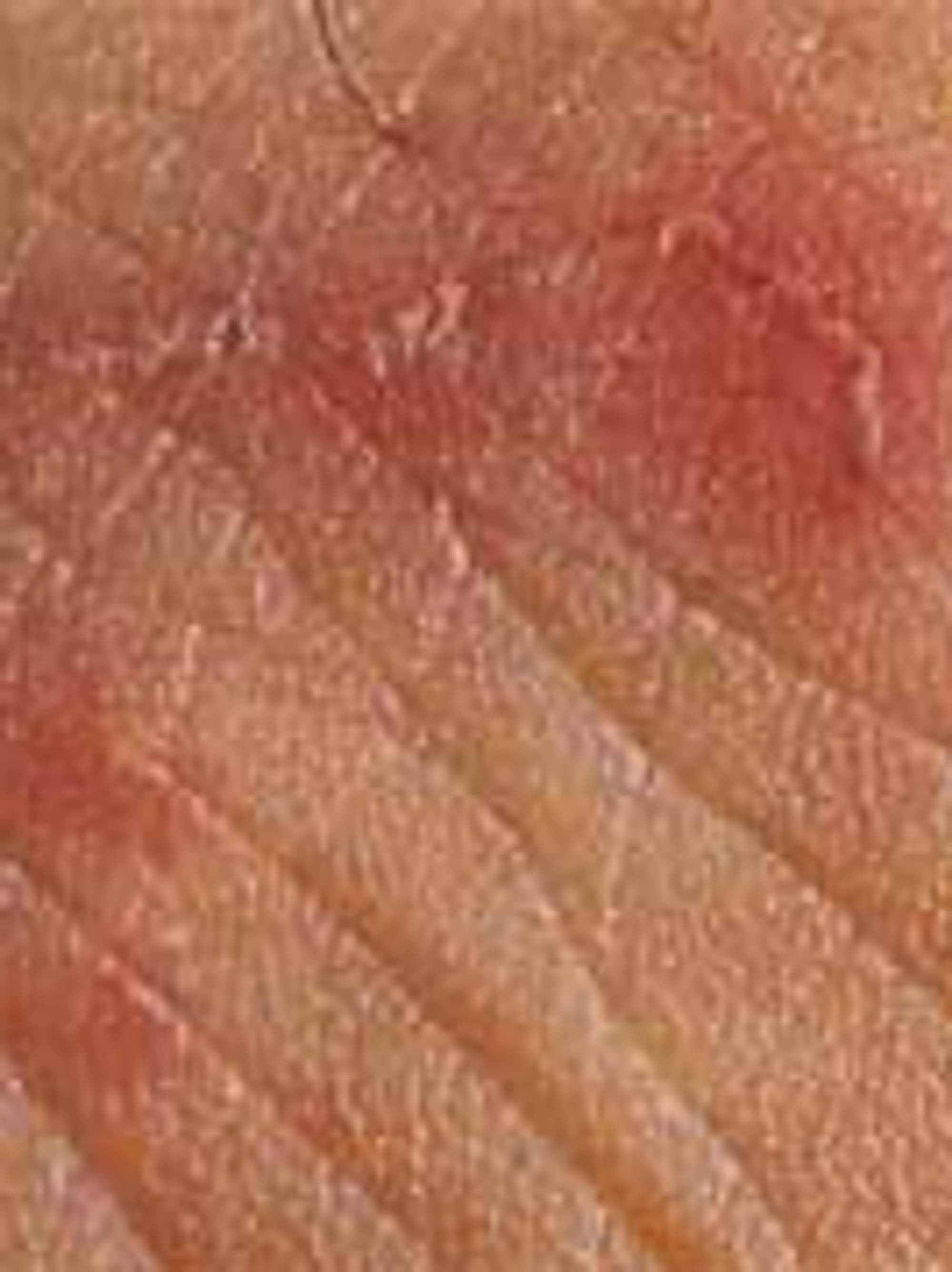 Eldre smittes av skabb på sykehjem – NRK Rogaland – Lokale nyheter, TV ...