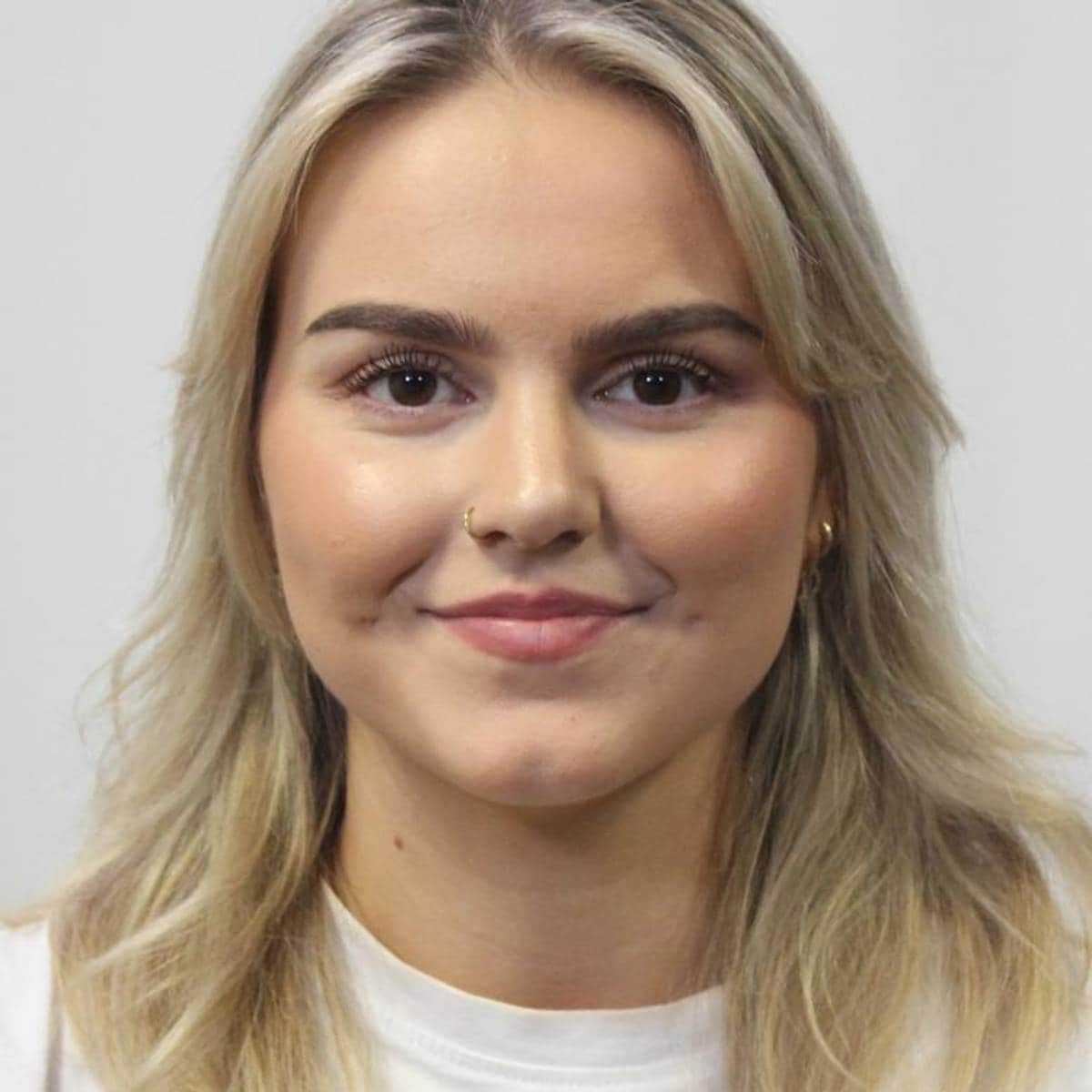 Bernt Marius Rørstad mista foten i ulykke: No blir det laga ...