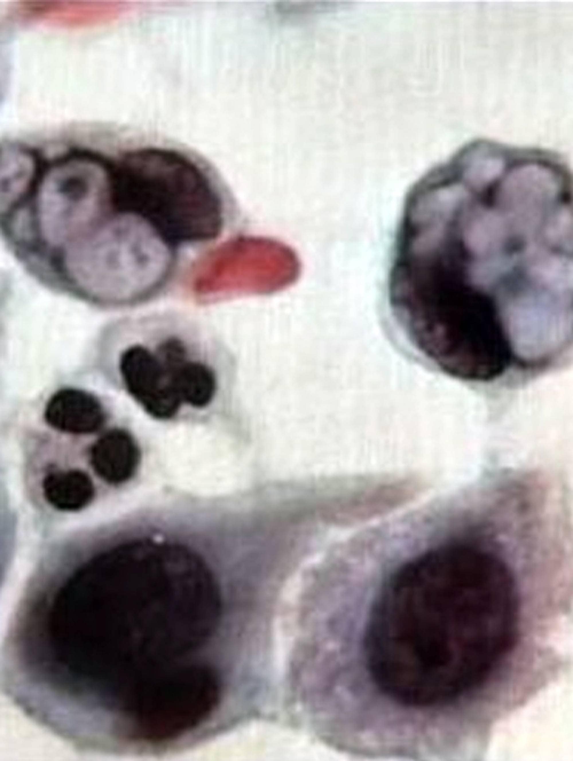 Menn gir blaffen i klamydia – NRK Trøndelag – Lokale nyheter, TV og radio