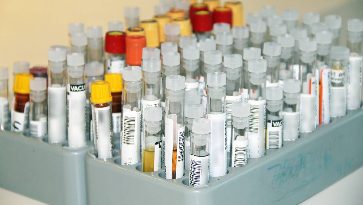 Først med elektroniske lab-prøver – NRK Nordland