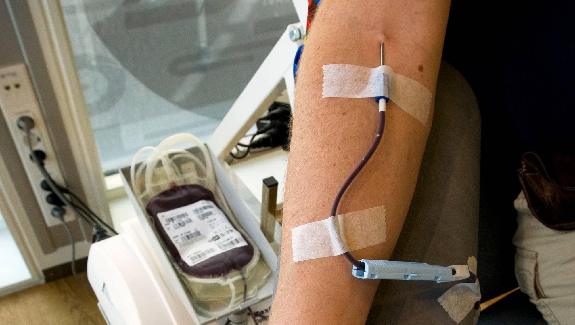 Strenge regler utelukker blodgivere – NRK Norge – Oversikt over nyheter ...