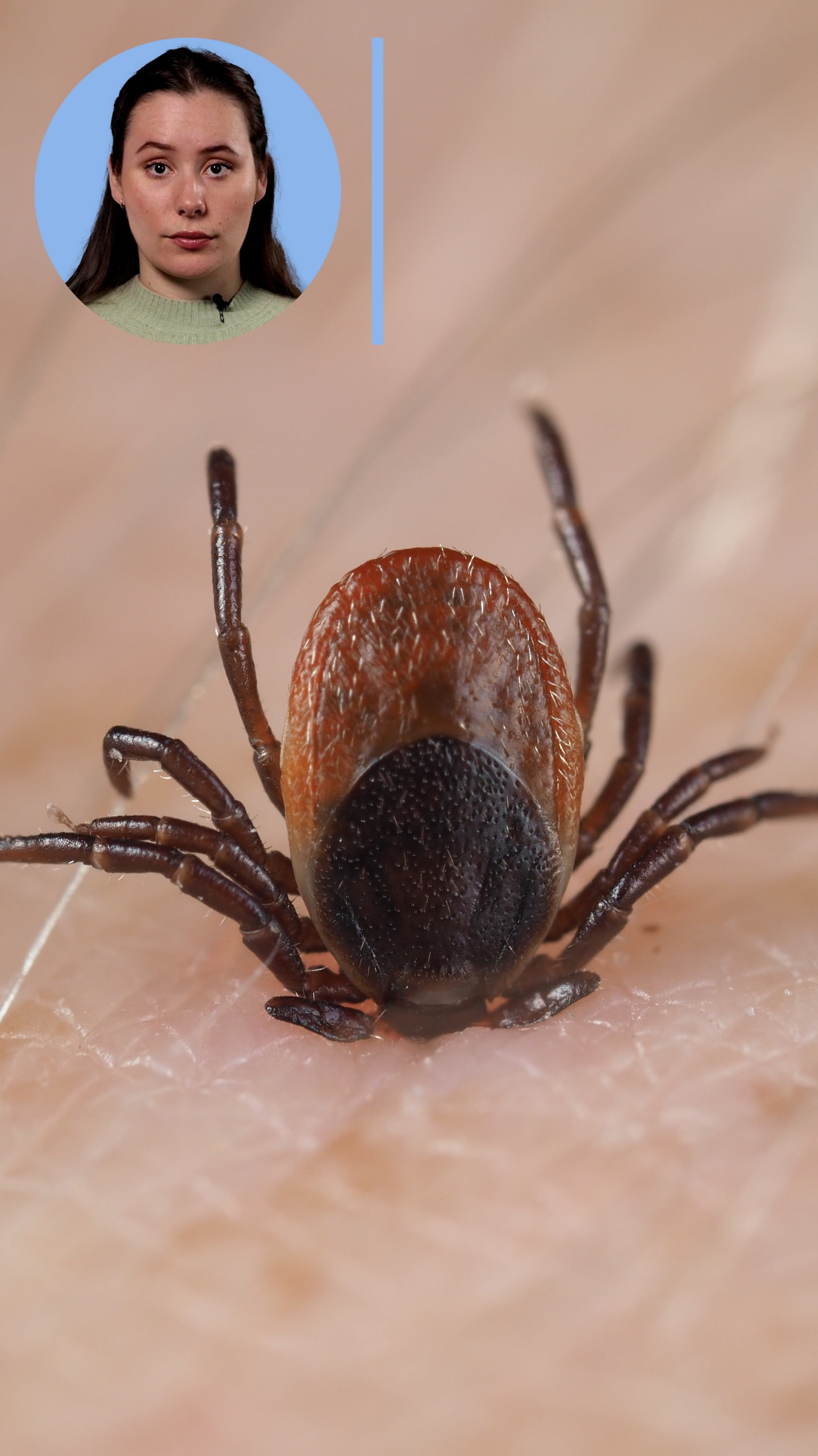 NRK Forklarer: Flått – NRK