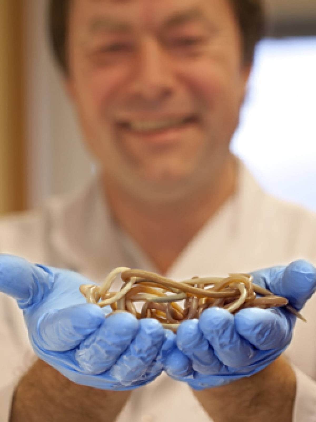 Barnemark fortsatt vanlig - de fleste vet ikke at de har det – NRK ...