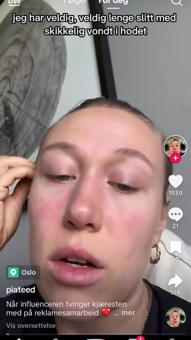 Sophie Elise brøt regelverk om reklame for Lonolux mot håravfall og ...