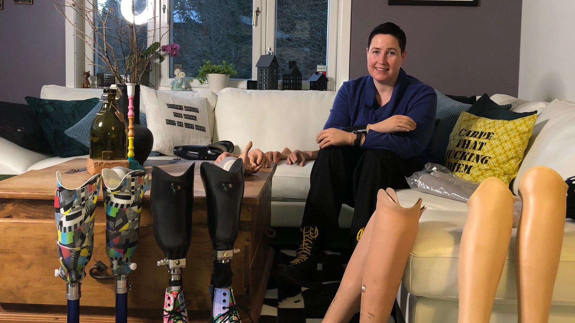 Gry Hege fra Båtsfjord i Finnmark måtte amputere hender og ben etter ...