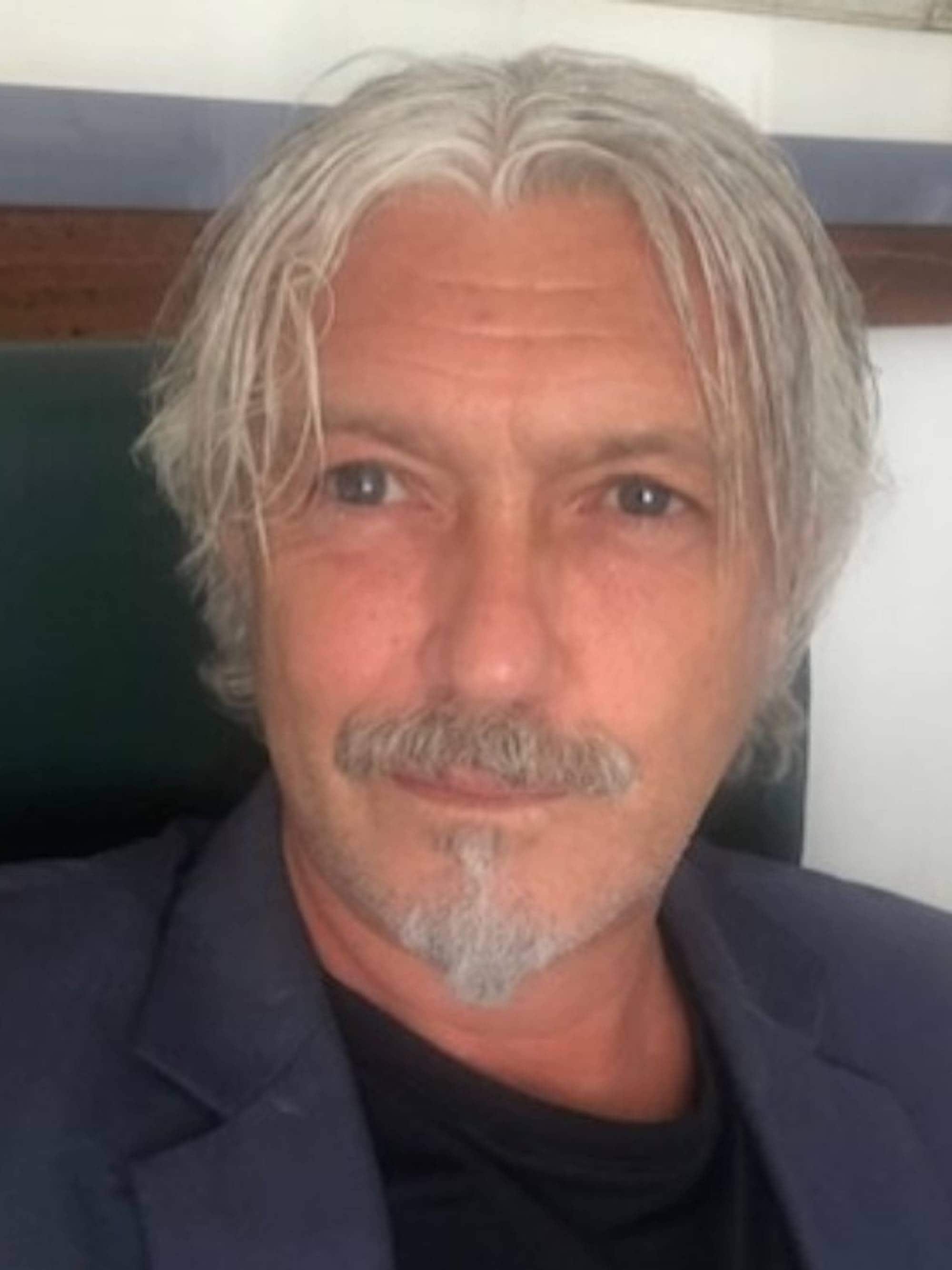 Forskere fant mikroplast i blodårer: Koblet til sykdomsrisiko og død – NRK Norge – Oversikt over ...