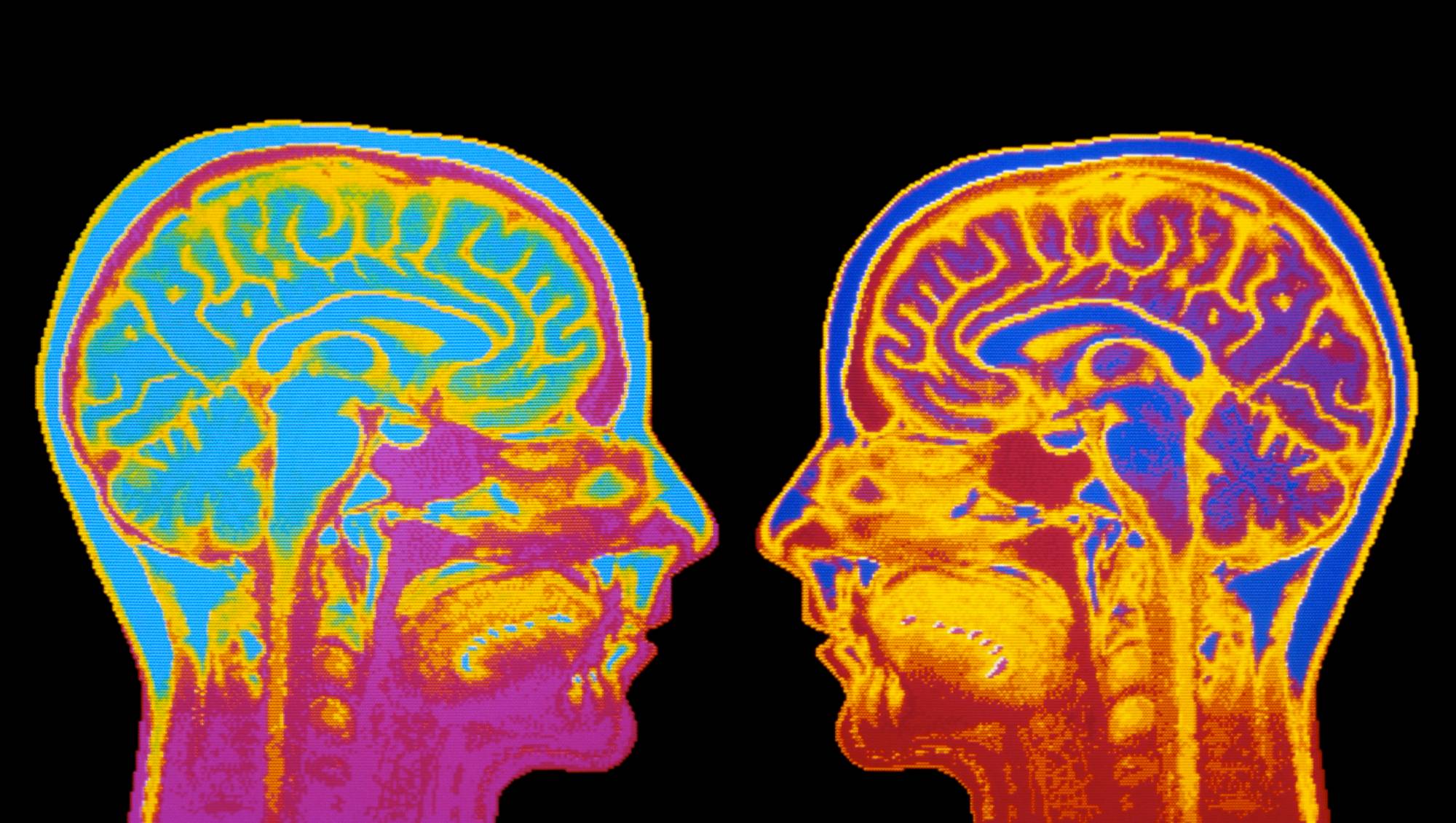 Psykisk lidelse er fysisk sykdom – Ytring