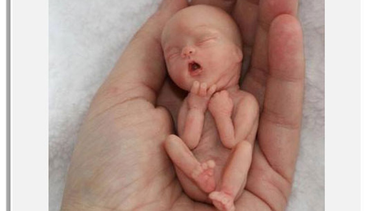 Kristiansens foster ut til million – NRK Sørlandet – Lokale nyheter, TV ...