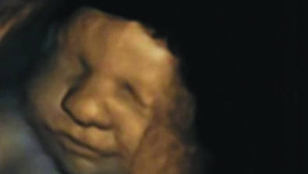 Babyer smiler allerede i mors liv – NRK Viten – Nyheter innen vitenskap ...