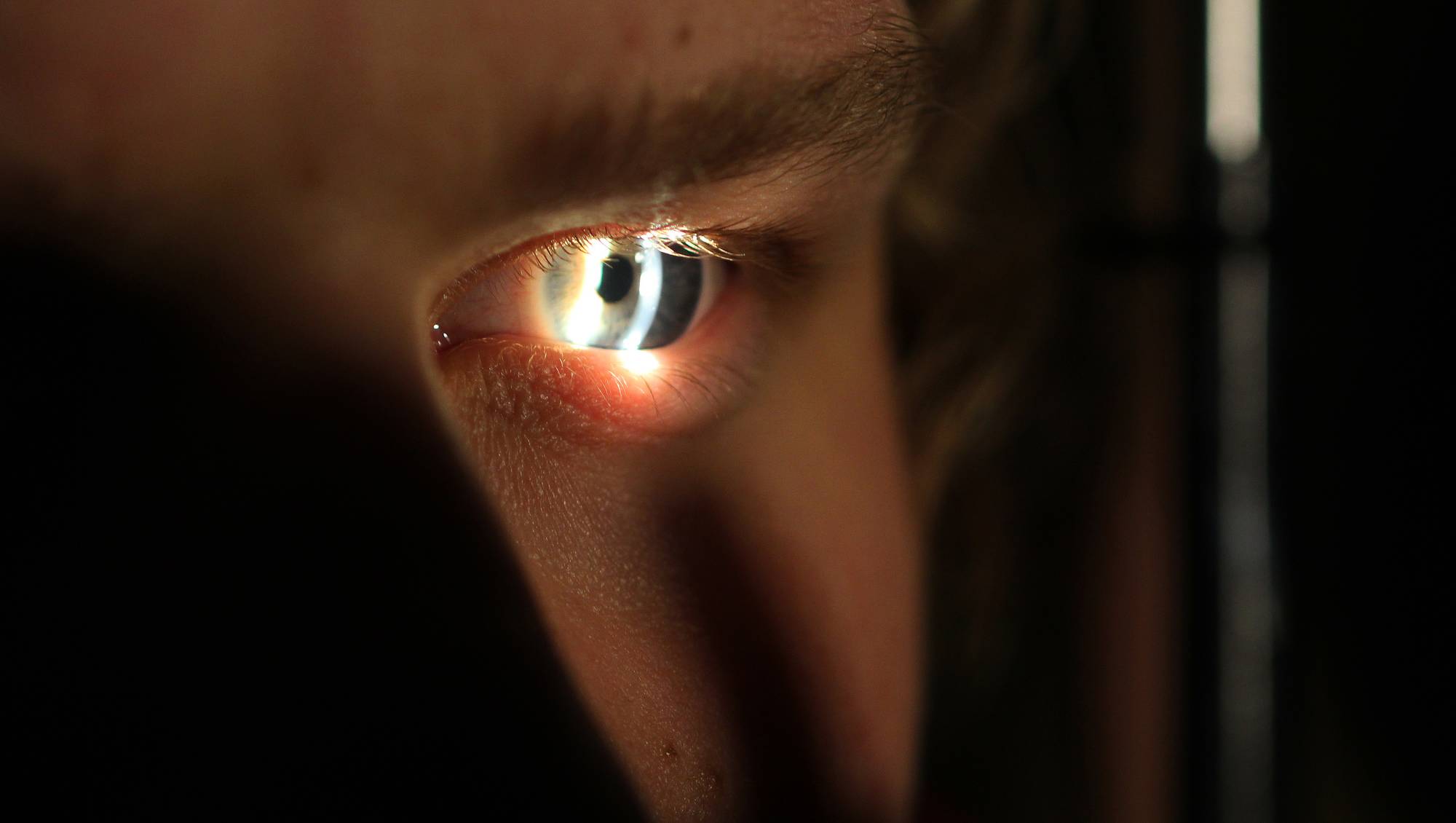 Nettkjøp gir feilbruk og øyeskader – NRK Nordland