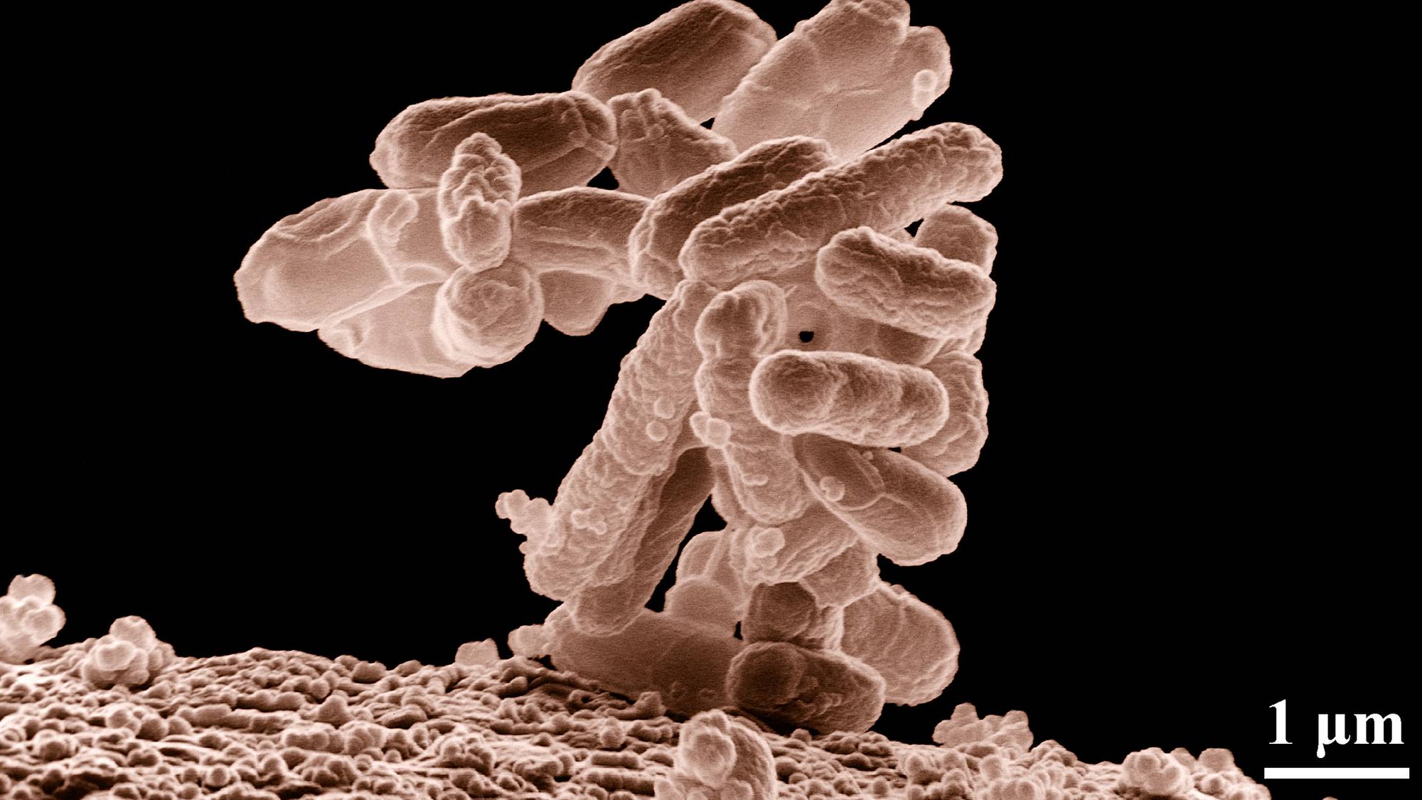 Noen kilo bakterier i kroppen – NRK Viten – Nyheter innen vitenskap og ...