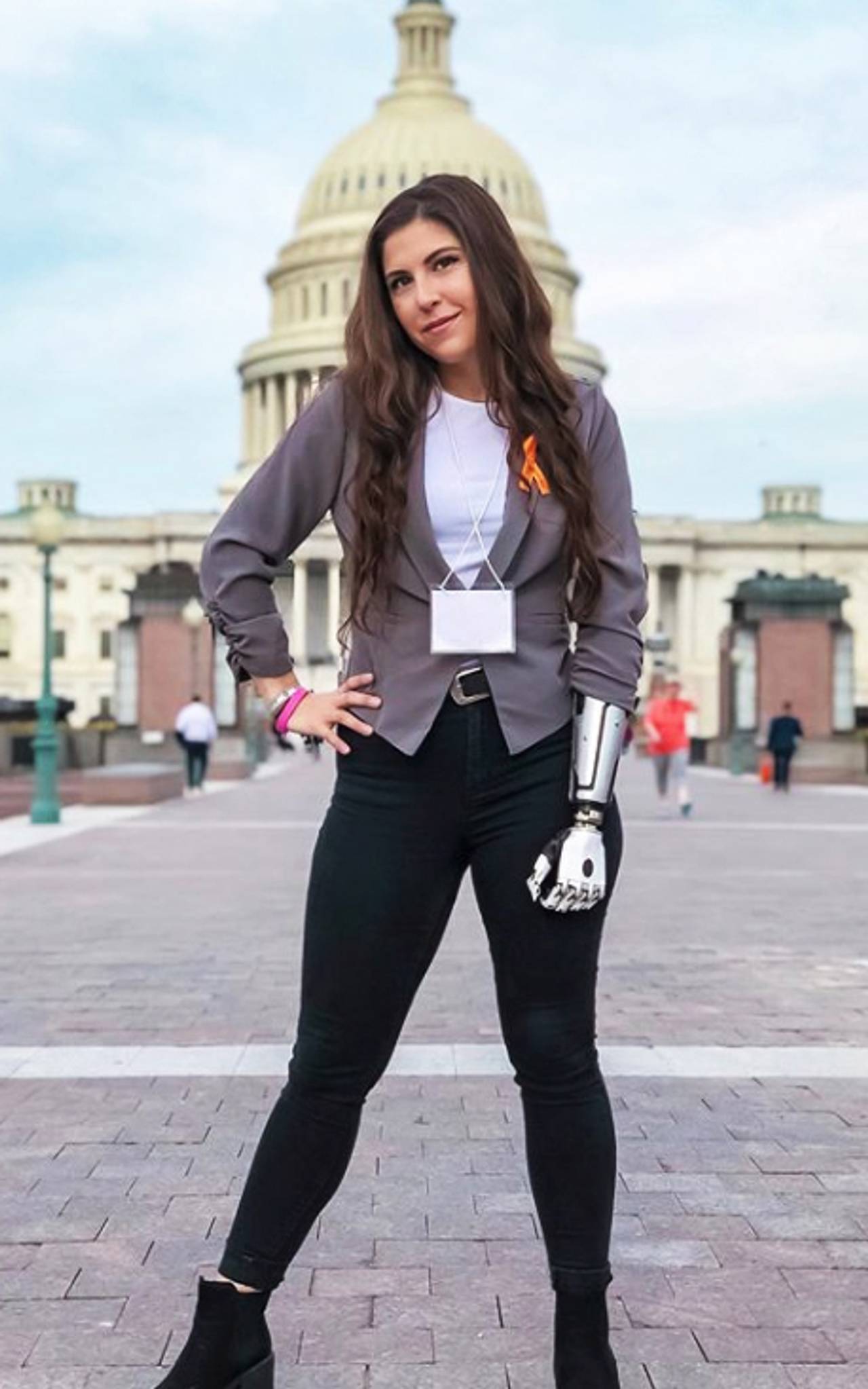 Sier avanserte armproteser forandrer forholdet til andre mennesker – Urix