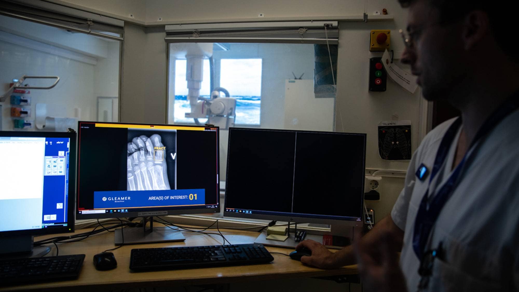 Ny teknologi i helsevesenet: Økt fare for dataangrep – NRK Troms og Finnmark