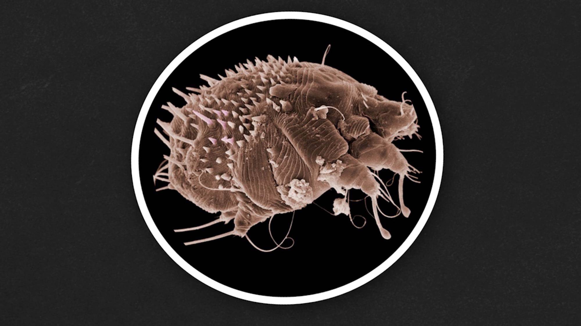 Økning i skabbtilfeller i Norge, FHI vil ha behandling på blåresept ...