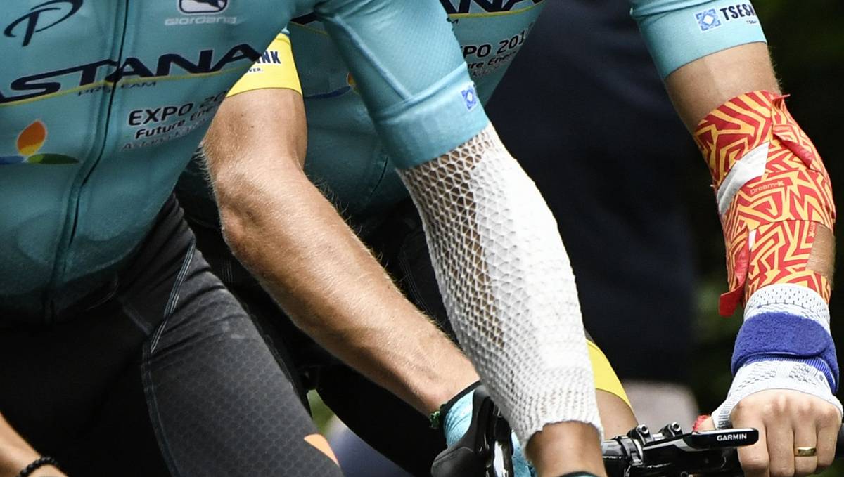 Fuglsang sykler med brudd i armen – NRK Sport – Sportsnyheter, resultater og sendeplan