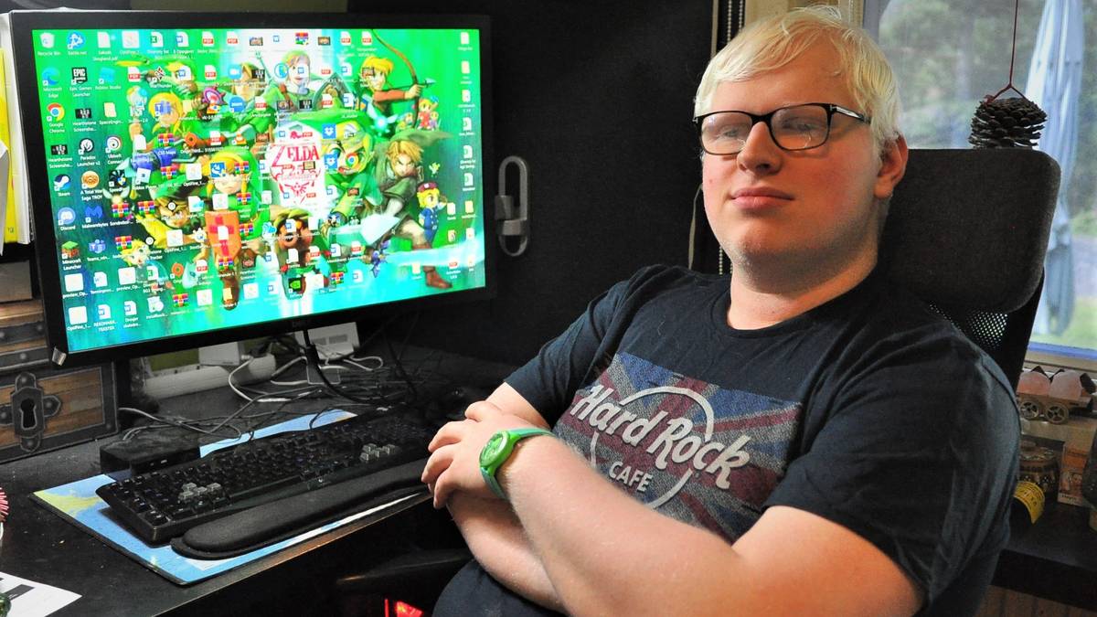 Sondre fra Kongsberg (21) har albinisme, ADHD og Asperger: – I ...