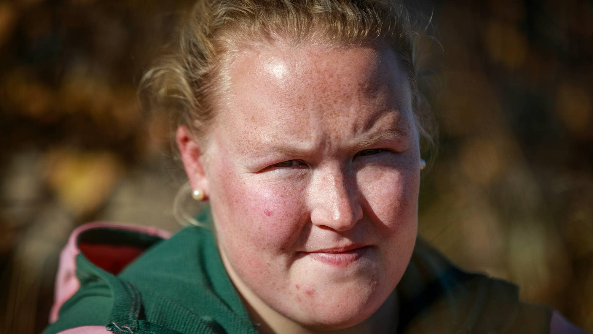 PCOS: Diagnosen med mange ansikter – Buskerud