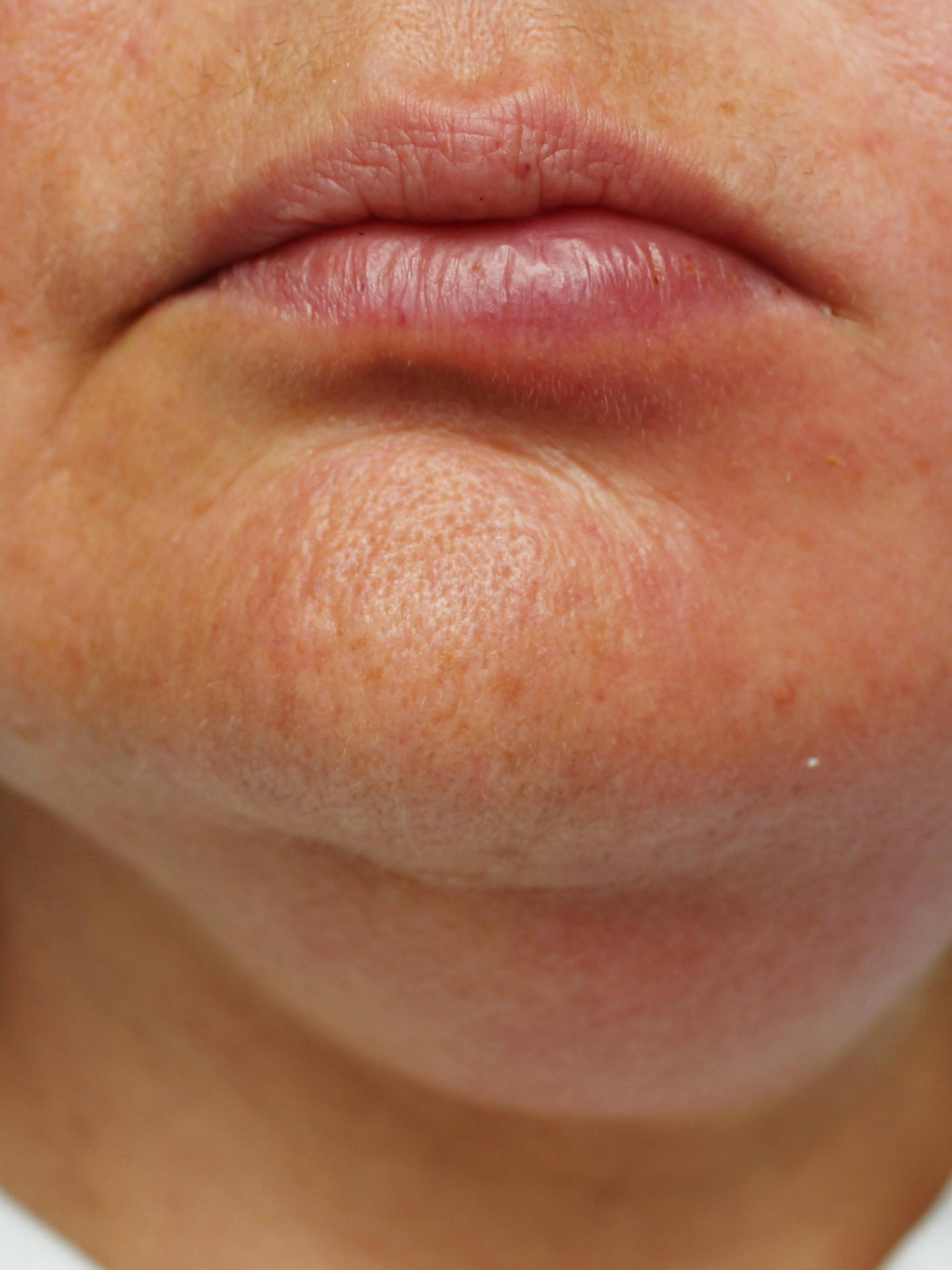 Helt unødvendig å bekymre seg – NRK Nyttig – Tips, råd og innsikt