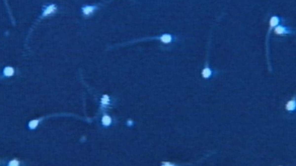 Norge på testikkelkreft-toppen – NRK Norge – Oversikt over nyheter fra ...