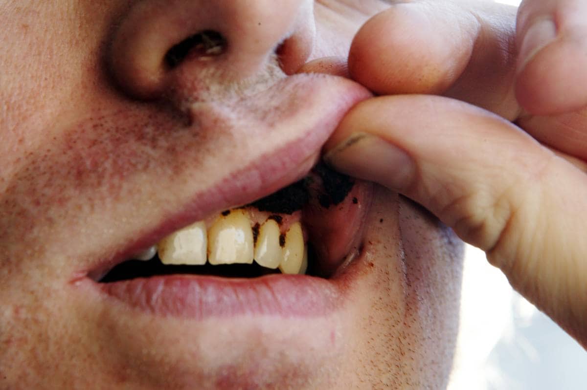 Unge Høyre mener snuslov må stoppes – NRK Norge – Oversikt over nyheter ...