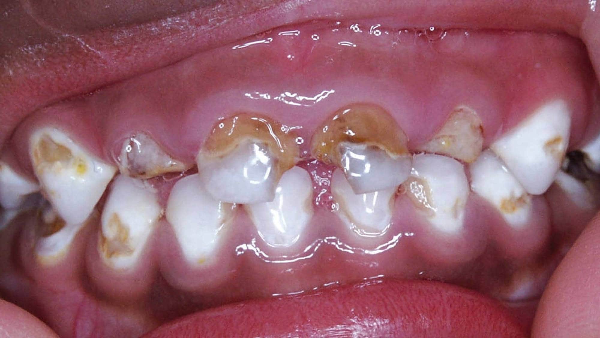 - Tenner avslører dårlige foreldre – NRK Rogaland – Lokale nyheter, TV ...