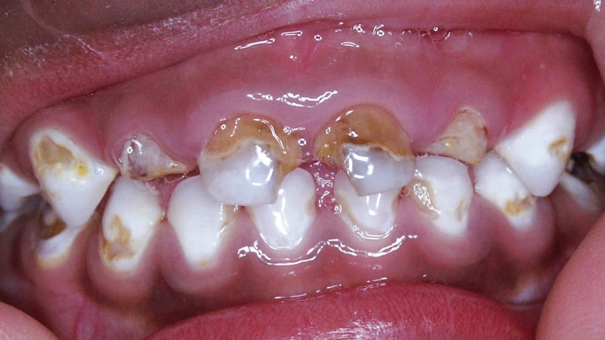 - Tenner avslører dårlige foreldre – NRK Rogaland – Lokale nyheter, TV ...