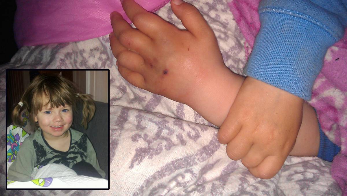 Emma (3) satte hånda fast i heisdør – NRK Troms og Finnmark