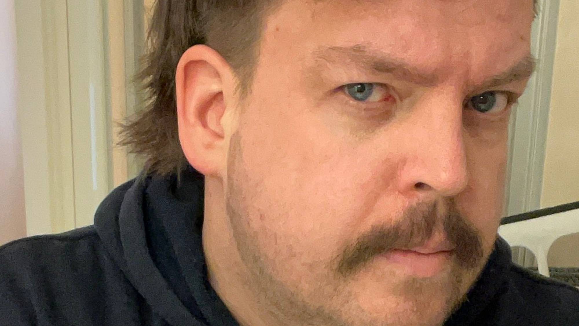 Runar Espejord frå Bodø/Glimt setter hockeysveis og bart på trend ...