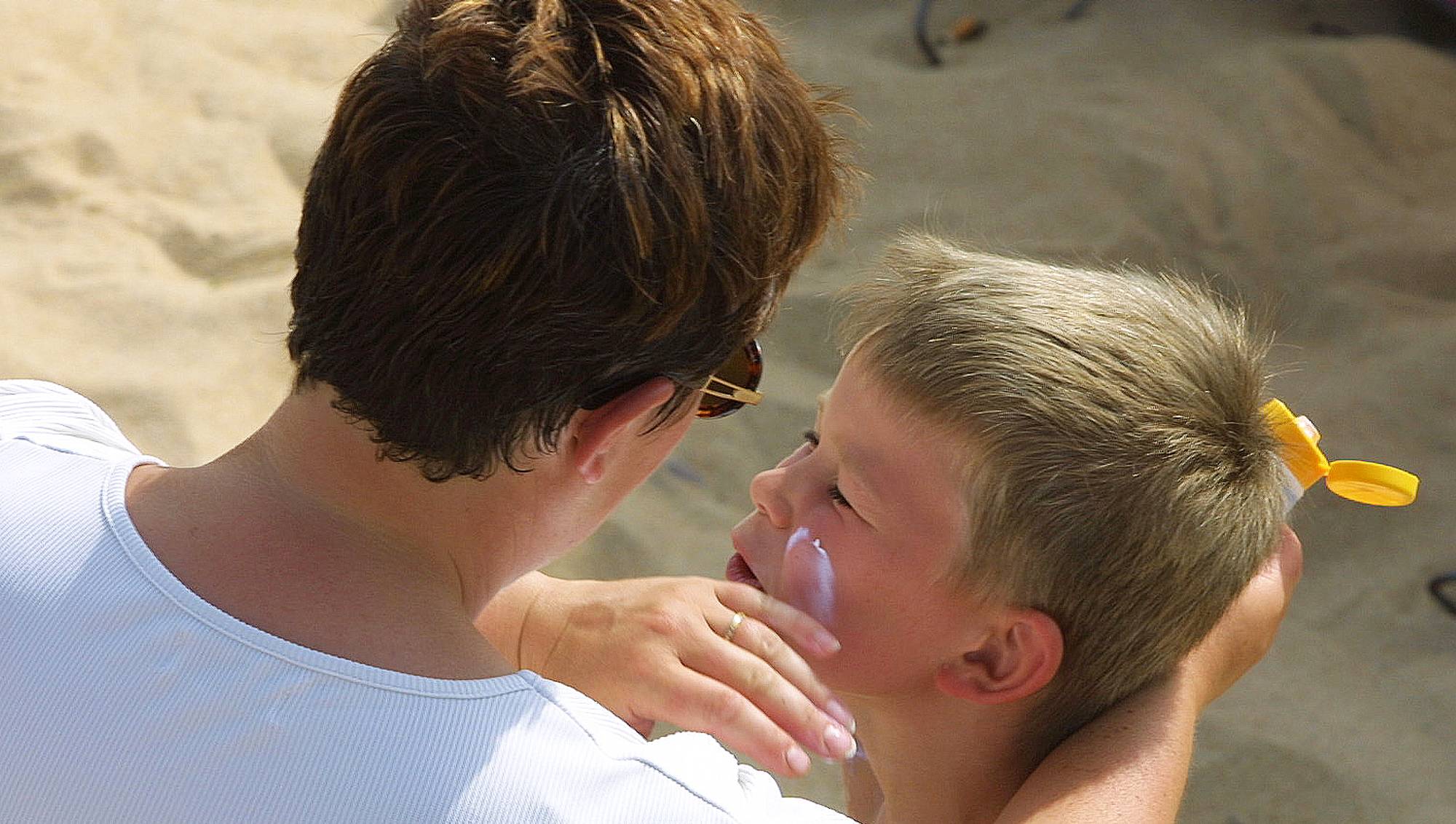 Økning i føflekkreft: – Du må ikke bli lurt av en høy solfaktor – NRK ...