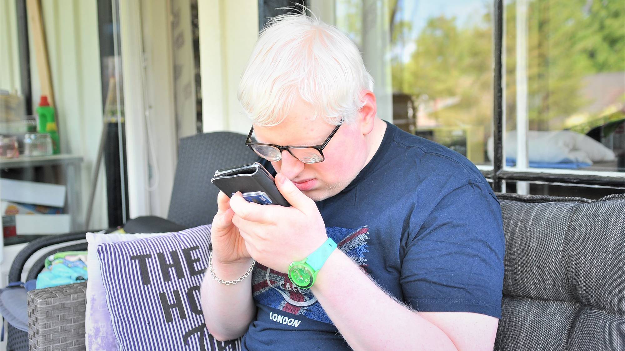 Sondre fra Kongsberg (21) har albinisme, ADHD og Asperger: – I ...